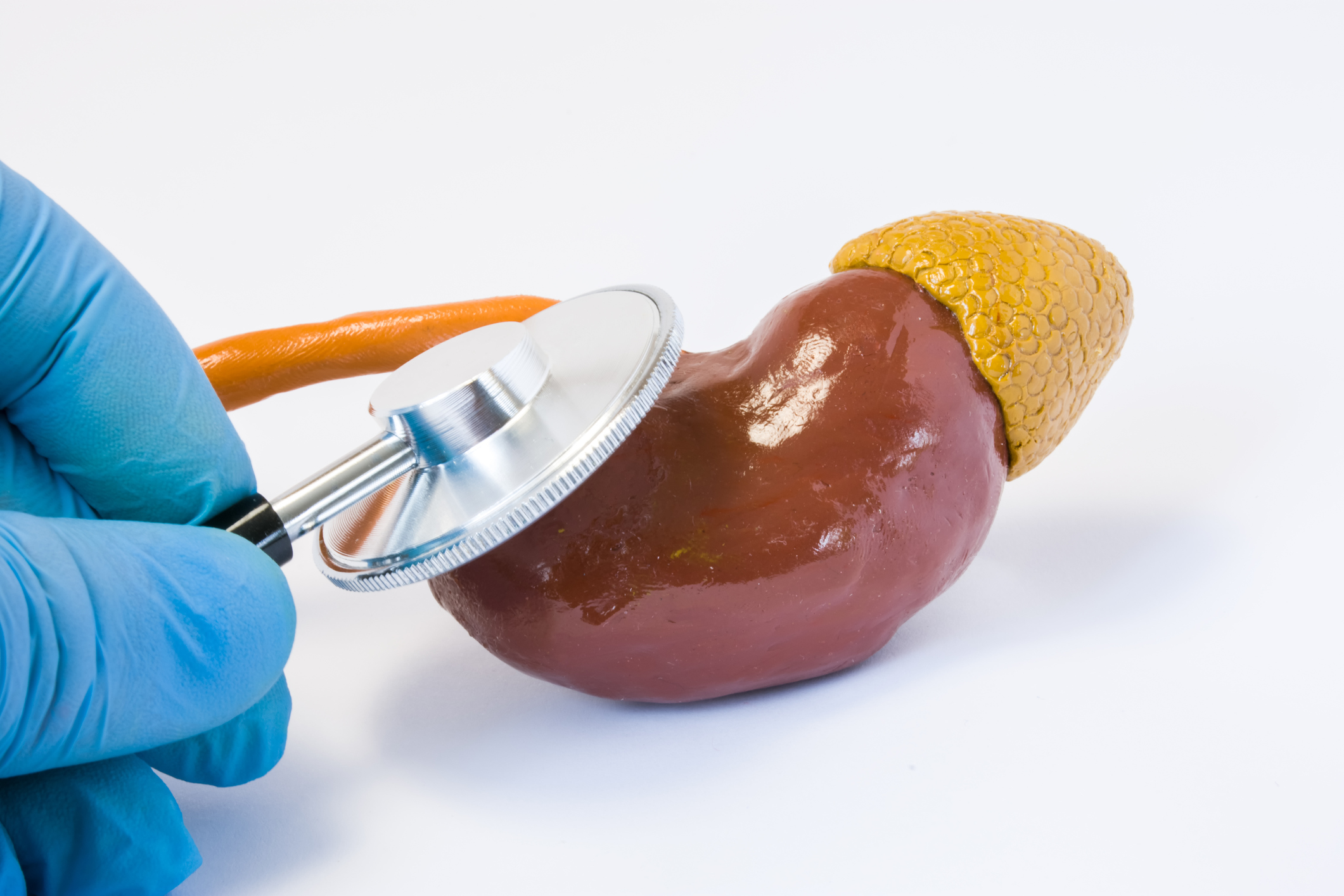 Sindrome di Cushing: cos'è e come si manifesta + Trattamento ...