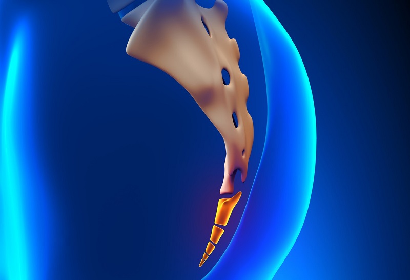 Quali sono le cause del dolore al coccige? Sindrome del coccige o ...
