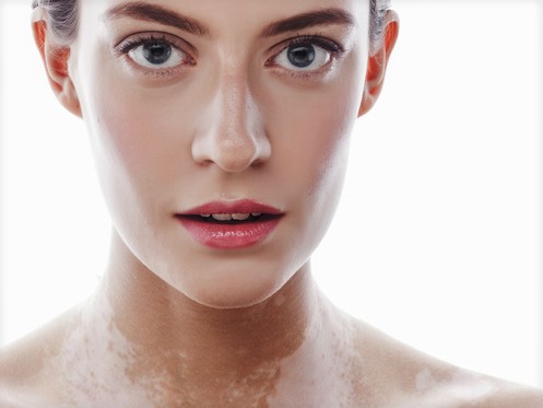 Perché si formano le macchie bianche sulla pelle? - Sintomo - MedicSpark.it