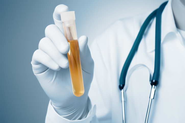 Urine torbide: quali sono le cause di urine pallide, bianche, schiumose ...